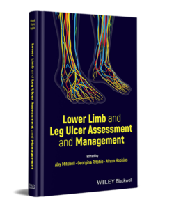 Our brand new book is published - "Lower limb and leg ulcer assessment ...